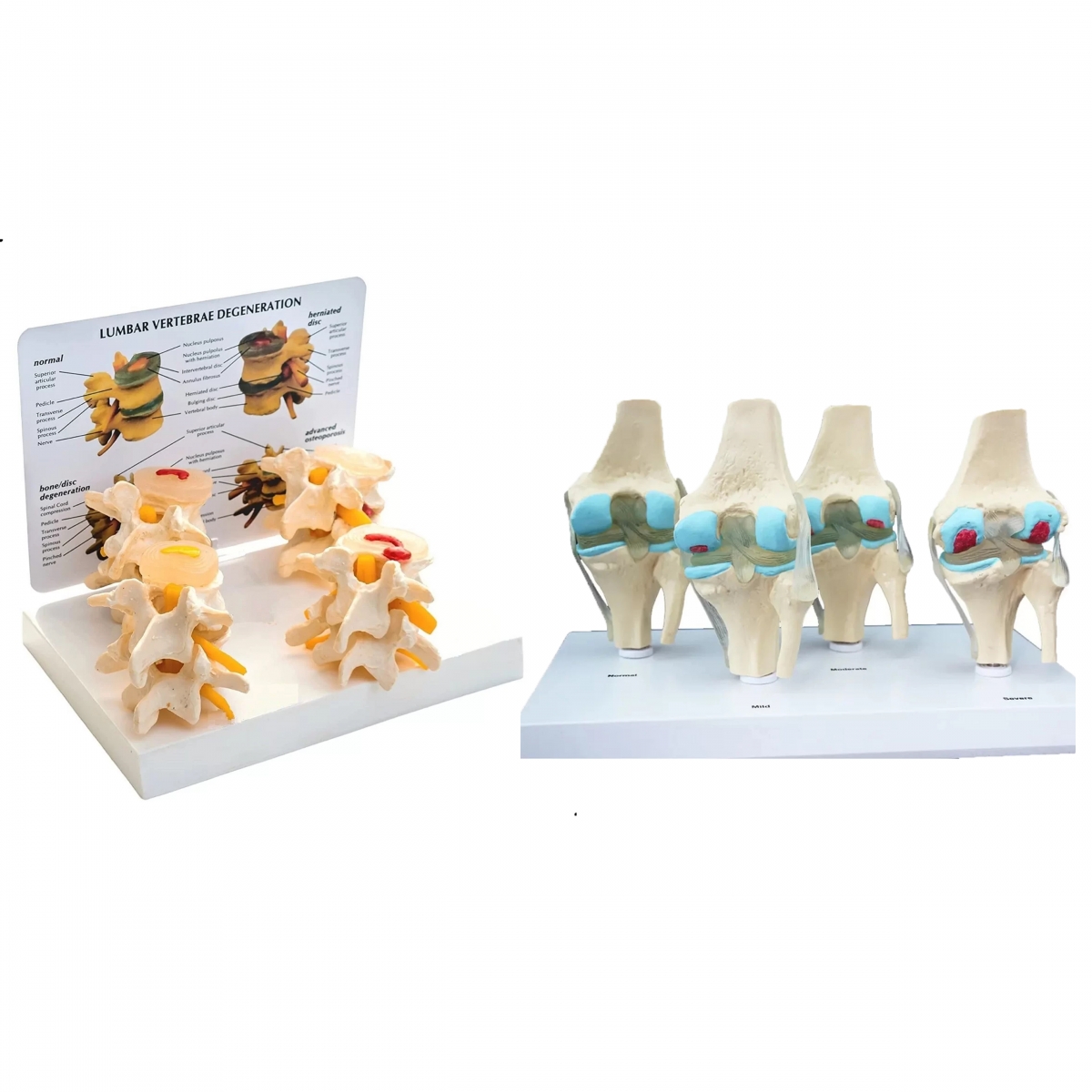 Joint Anatomy & Pathology Bundle - Myaskro